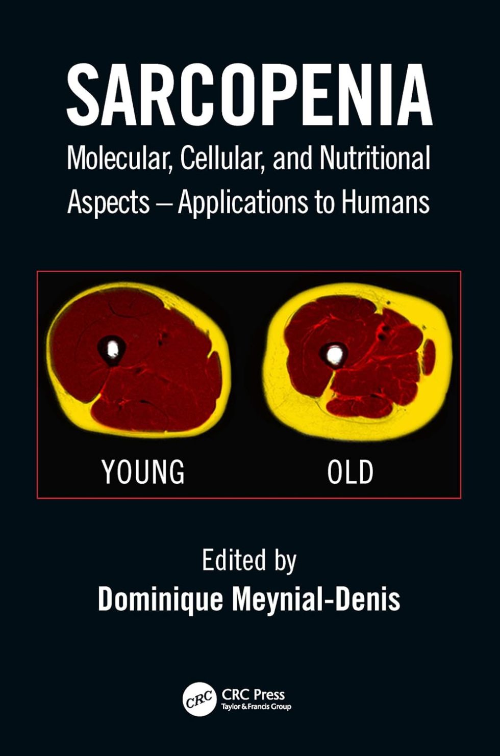 Tengo Sarcopenia: que es y cómo combatirla - Equilibrium Central Wellness Tengo Sarcopenia: que es y cómo combatirla - Equilibrium Central Wellness